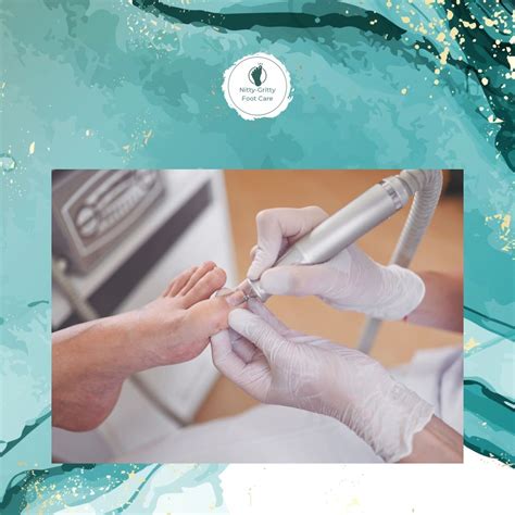 Nittygrittyfootcareca Foot Care Nurse Mobile Foot Care Foot Care