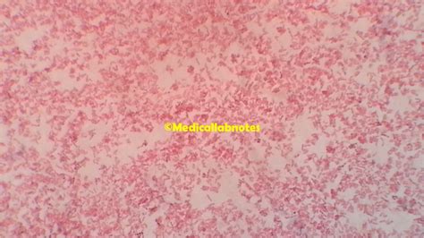 Corynebacterium Diphtheriae Introduction Morphology Pathogen