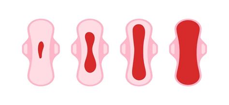 Menorrhagia What You Need To Know About Heavy Menstrual Bleeding