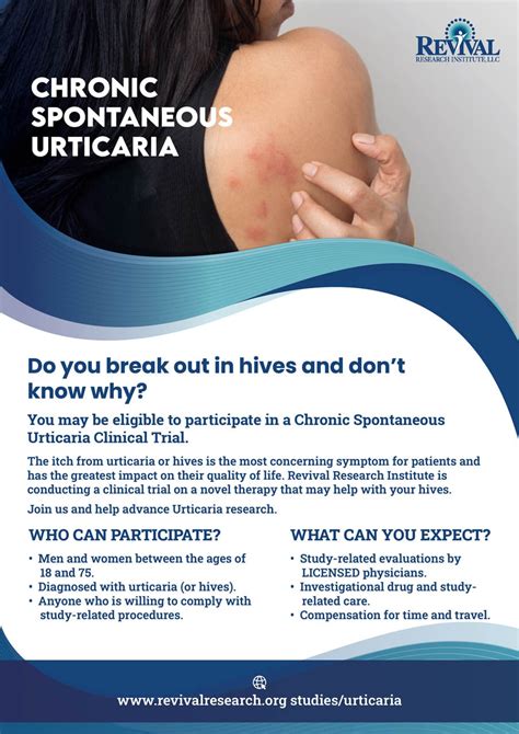 Chronic Spontaneous Urticaria Clinical Trials In Michigan