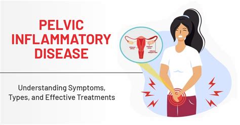 Pelvic Inflammatory Disease Pid Causes Symptoms