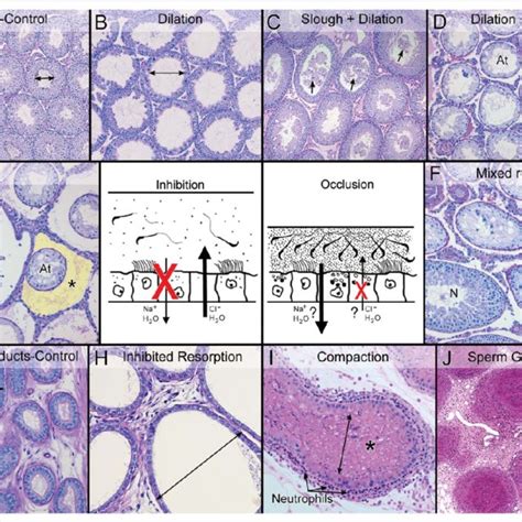 Testis And Efferent Ductules In The Wild Type Wt And Esr1ko Mice A