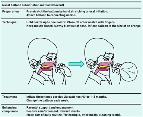 Glue Ear Causes Symptoms Diagnosis Treatment And Prognosis
