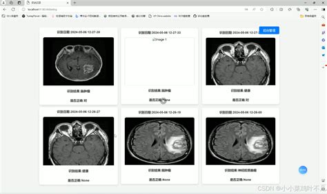 基于深度学习的医学图像分类与诊断系统（开题报告免费领）医学图像分类系统 Csdn博客