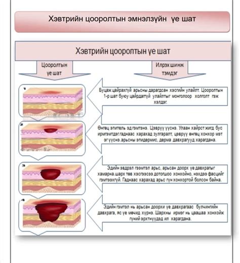 Гэмтлийн Тасаг Яагаад сувилагч нар 2 цаг тутам өвчтөний байрлалыг нь солиорой гэдэг вэ Бяцхан