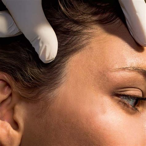 Smooth Pdo Threads In New York Ny And Watchung Nj Aesthetify