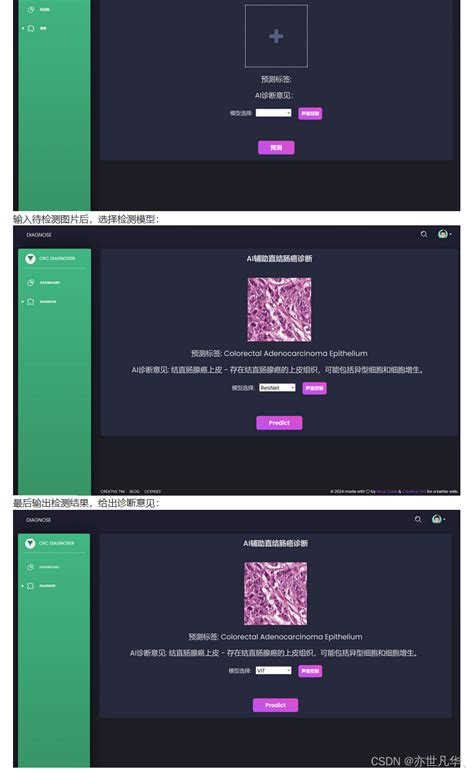 【传知代码】双深度学习模型实现结直肠癌检测（论文复现）selfencoder Nnmodulelist Csdn博客