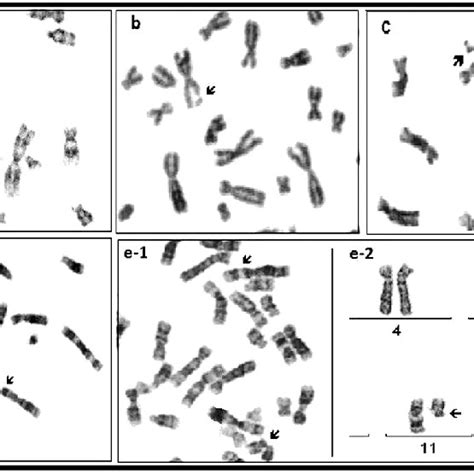Representative Chromosome Aberrations Arrows In Metaphase Spreads A Download Scientific