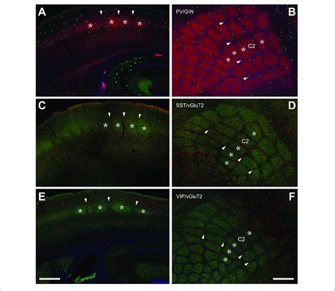 Localization Of Pv Sst And Vip Interneurons In The Barrel