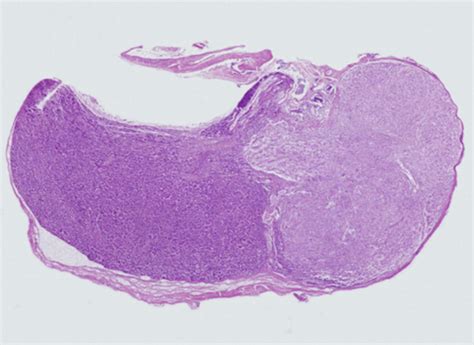 Endocrine Exam 1 Flashcards Quizlet