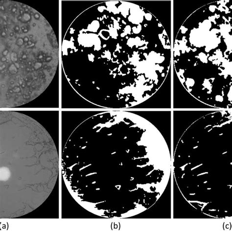 Segmented Results From Model 2 First Row Shows Positive Pco And Second
