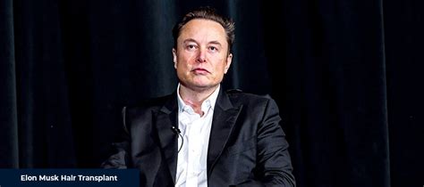Elon Musk Hair Transplant 2023 Smile Hair Clinic