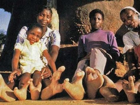 Meet The Tribe With Ostrich Feet Andrei Tapalaga Newsbreak Original