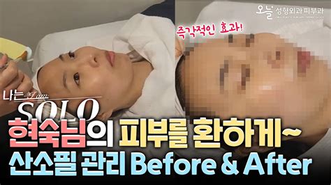 칙칙한 피부를 맑고 환하게 🥰 딥클렌징과 각질 제거 산소필 관리 나는 솔로 6기 출연자 Youtube