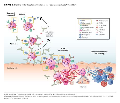 Antineutrophil Cytoplasmic Antibody Anca Vasculitis Pathophysiology
