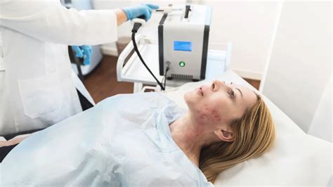 Understanding Rosacea Vs Lupus Key Differences Explained