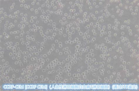 Ccrf Cem Ccrf Cem 人急性淋巴细胞白血病t淋巴细胞价格详情介绍 960化工网 960化工网