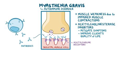 Video Acetylcholinesterase Inhibitors For Myasthenia Gravis Nursing