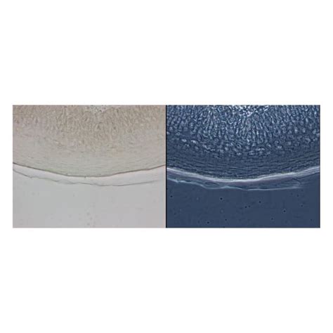 Zeiss Primostar 3 Phase Contrast Microscope Buy Online Blue Care