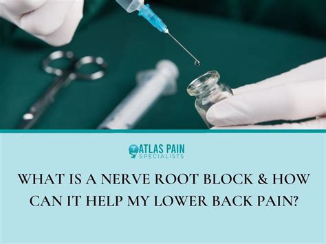 How Does A Nerve Root Block Work At Nickole Williams Blog