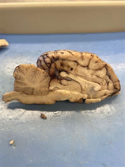 Lab Practical 1 Nervous System Brain Disection Diagram Quizlet