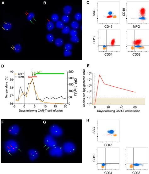 molecular detection of t 8 21 in the bone marrow a c diagnostic sample