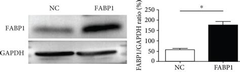 Fabp1 Inhibits The Proliferation And Migration Of Liver Cancer Cells