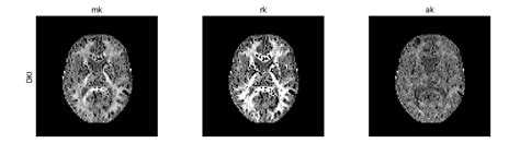 Reconstruction Of The Diffusion Signal With The Kurtosis Tensor Model Dki — Dipy 1110