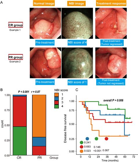 Figure 2 From Narrow Band Imaging Based Radiogenomics For Predicting Radiosensitivity In