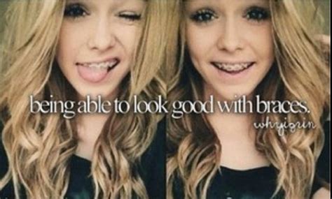Acacia Brinley Clark Braces