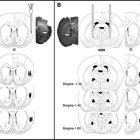 Coronal Section Diagrams And Representative Photomicrographs Of