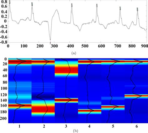 a ecg signal segment from beat number 74 to 80 of recording chf06