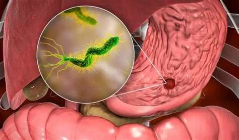 이 기름은 꼭 챙겨 드세요 먹을 수록 혈관 위장 혈당에 좋고 암 사망률 40 낮춰주는 놀라운 기름 1가지 모범뉴스
