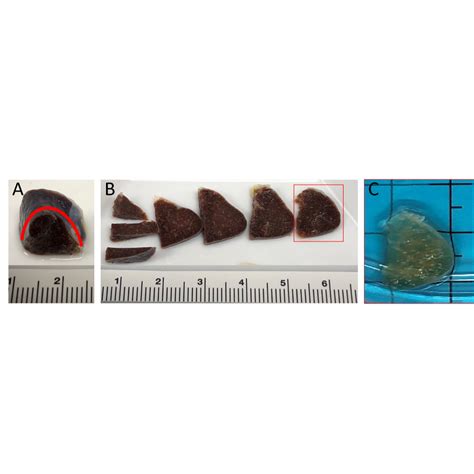 Lightsheet Tissue Intake Photodocumentation And Tracking
