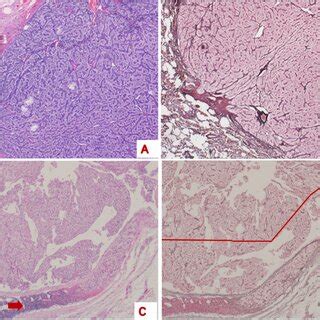 Representative Histological Features And Reticular Fibre Staining Of