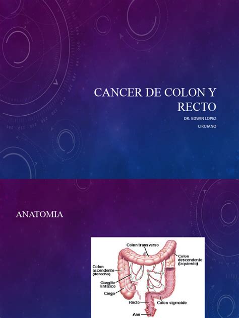 Cancer de Colon | PDF | Cáncer colonrectal | Causas de la muerte