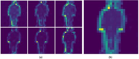 Gait Recognition With Self Supervised Learning Of Gait Features Based On Vision Transformers