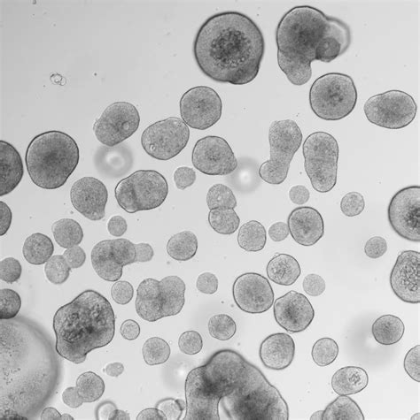 Adenoid Organoids Lambda Biologics