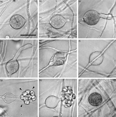 Sporangia And Hyphal Swellings Of Pythium Litorale Ac Sporangia