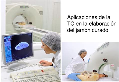 La Tomografía Computarizada Serofca