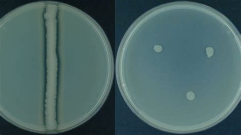 Casein Hydrolysis Test Principle Procedure Result Biology Notes