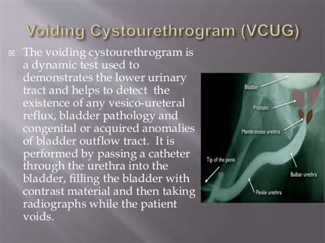 mcu micturating cysto urethrogram