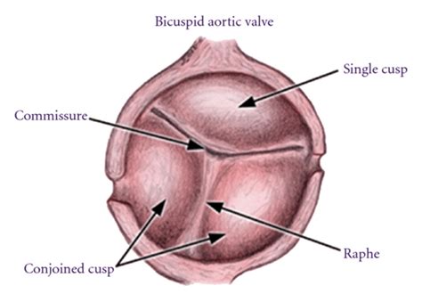 Human Heart Diagram Bicuspid Valve 4 Valves Of The Heart What Are They How They Work In Some