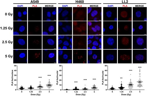 Proximity Ligation Assay Analysis Using Antibodies Specific For La Ssb Download Scientific