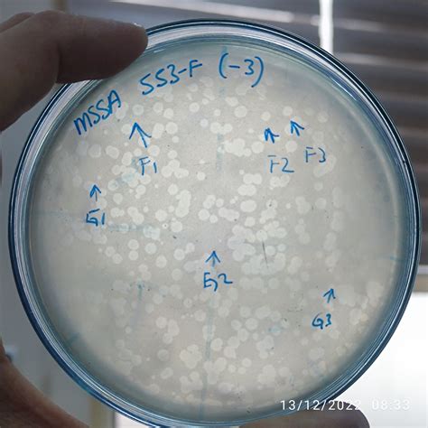 Staphylococcus Aureus Bacteriophage 152553f Mikroliz