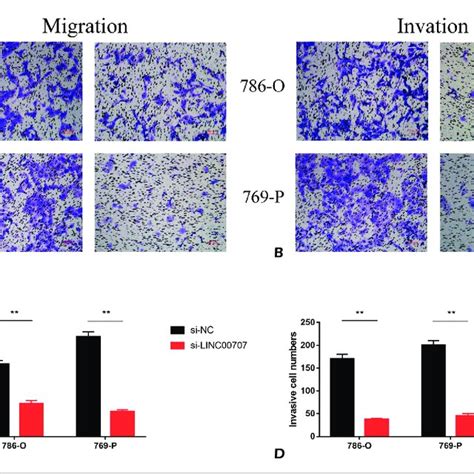 Knockdown Of Linc00707 Suppressed The Migratory And Invasive Abilities