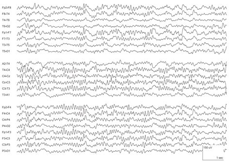 Gallery The Eeg Game
