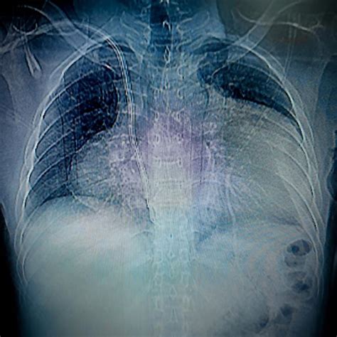 Kullanıcı Radiography Ekşi Sözlük