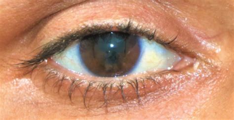 Clinical Features Of The Patient At The Time Of Presentation Bilateral Download Scientific