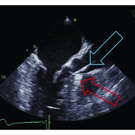 Flowchart Showing Patient Selection And Follow Up Download Scientific Diagram